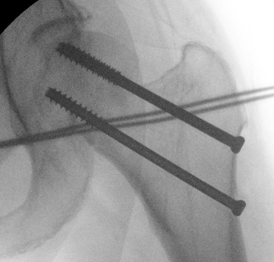 Fixation | The Bone School